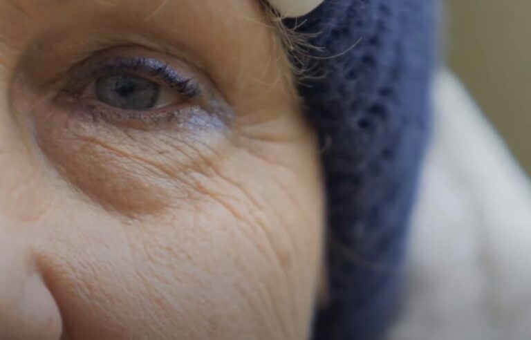 What is a Cataract? - A Detailed Insight