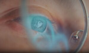 How Long to Wear Eye Shield at Night After Cataract Surgery - Best ...